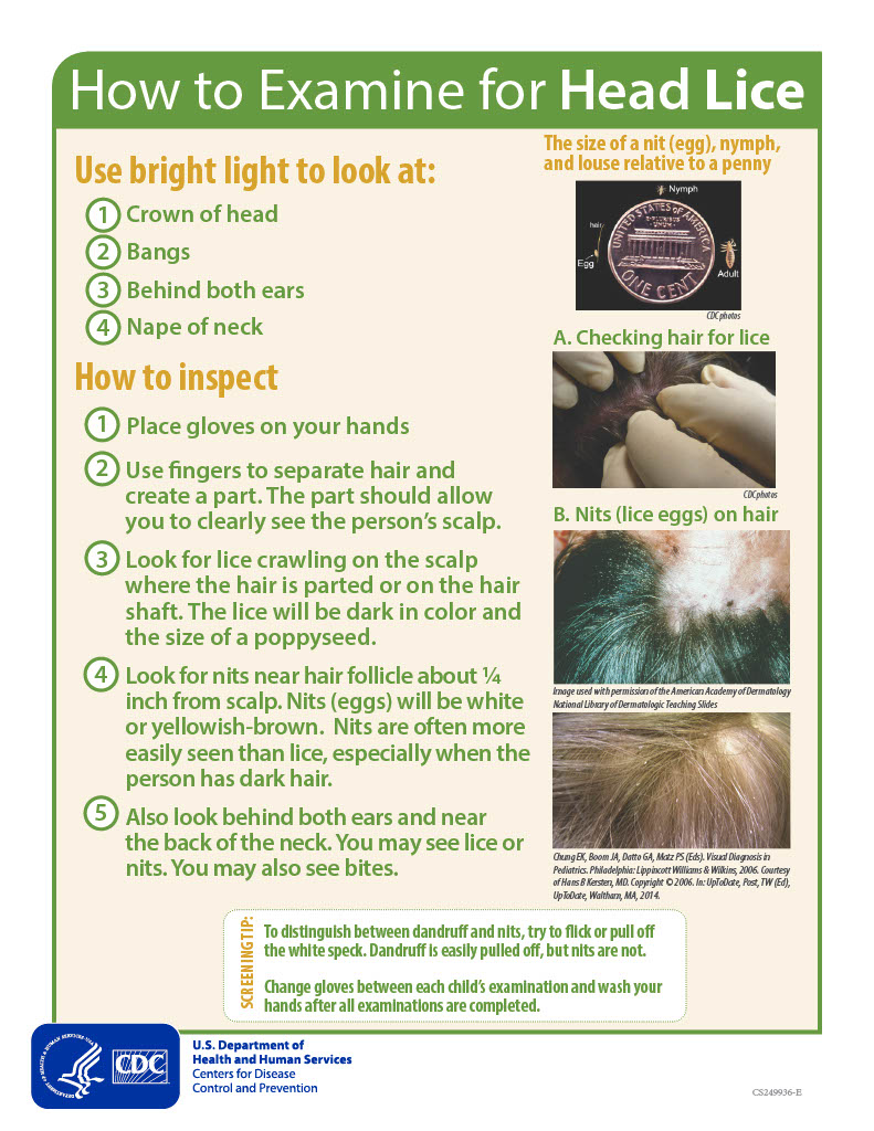 How To Get Rid Of Lice How To Get Rid Of Lice